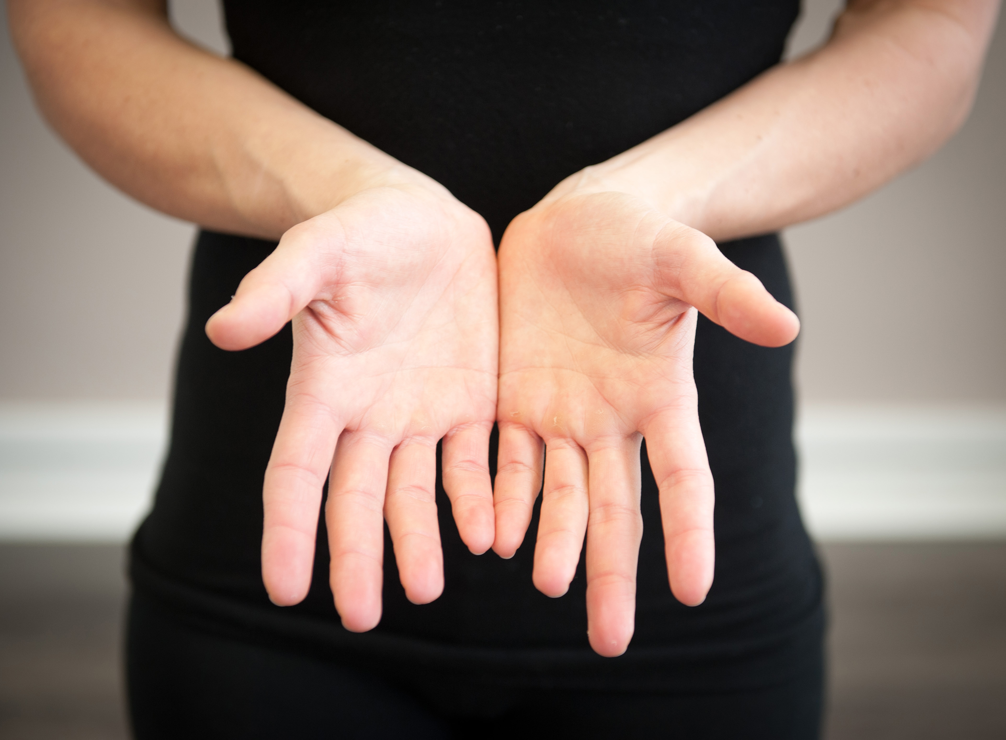 Annelizes' story - Case studies - Happy customers - Physio123